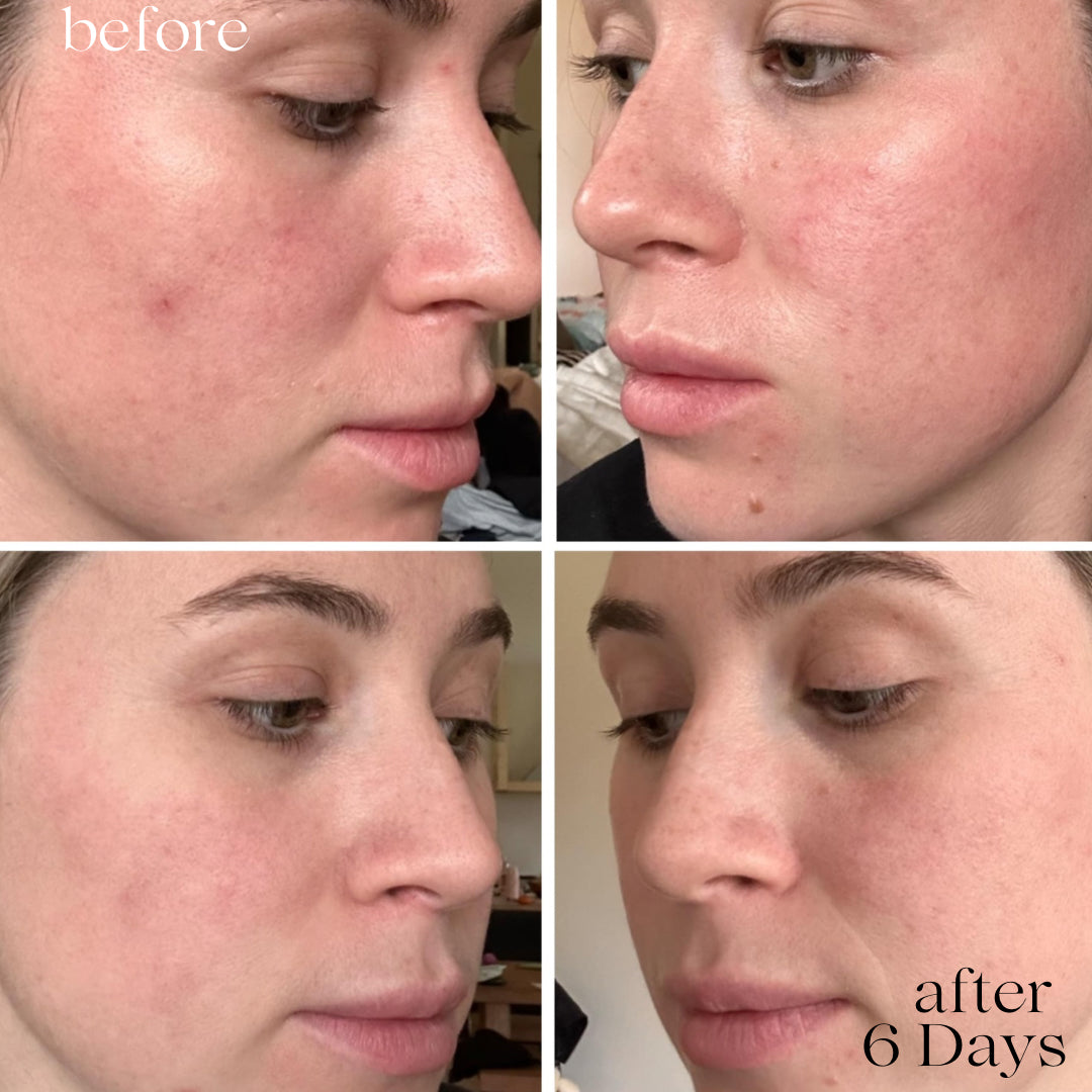 Tal-Glow Skincare