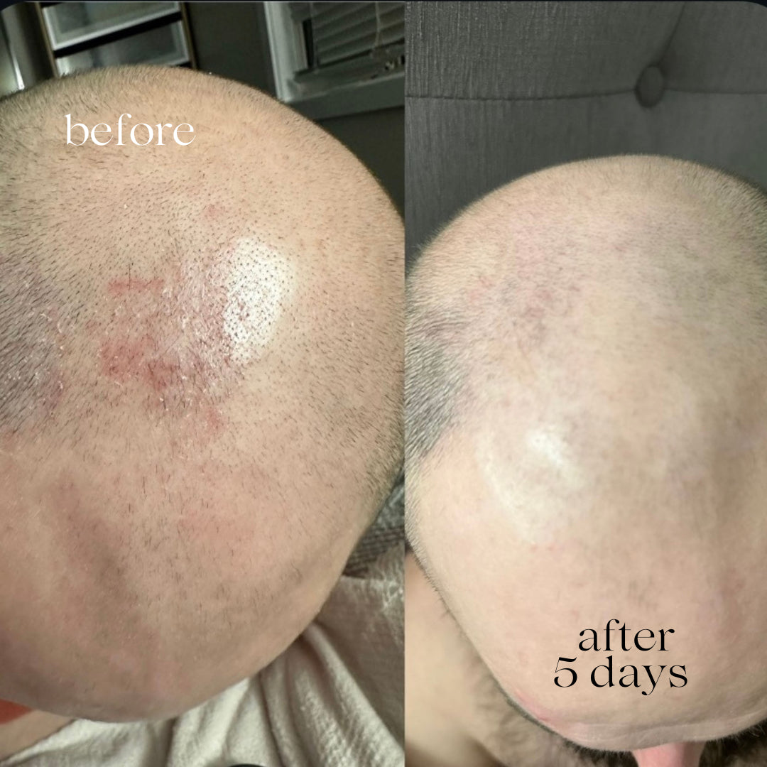 Tal-Glow Skincare