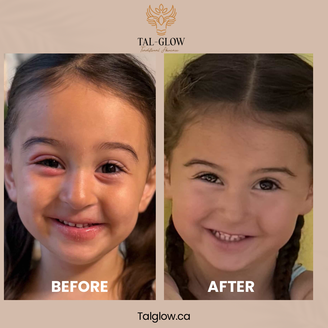 Tal-Glow Skincare